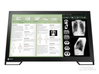 【高清图】艺卓(Eizo)Eizo RadiForce RX440整体外观图 图1-ZOL中关村在线